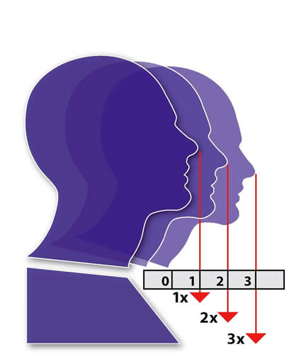 Rolfing in Austin: Common Types of Structural Misalignments | Gina ...